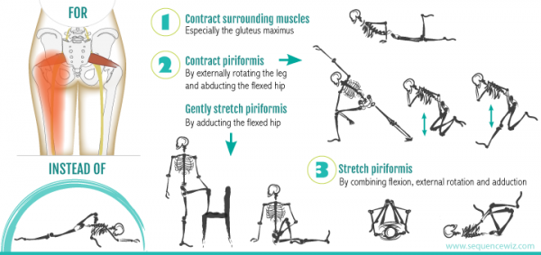 3 types of pain in the butt and what you can do about it