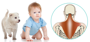 What causes neck stiffness and tension headaches and how we can deal ...